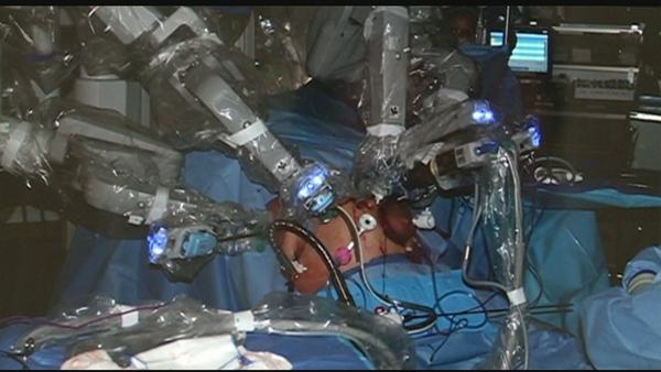 Robotic surgery helping pancreatic cancer patients | king5.com