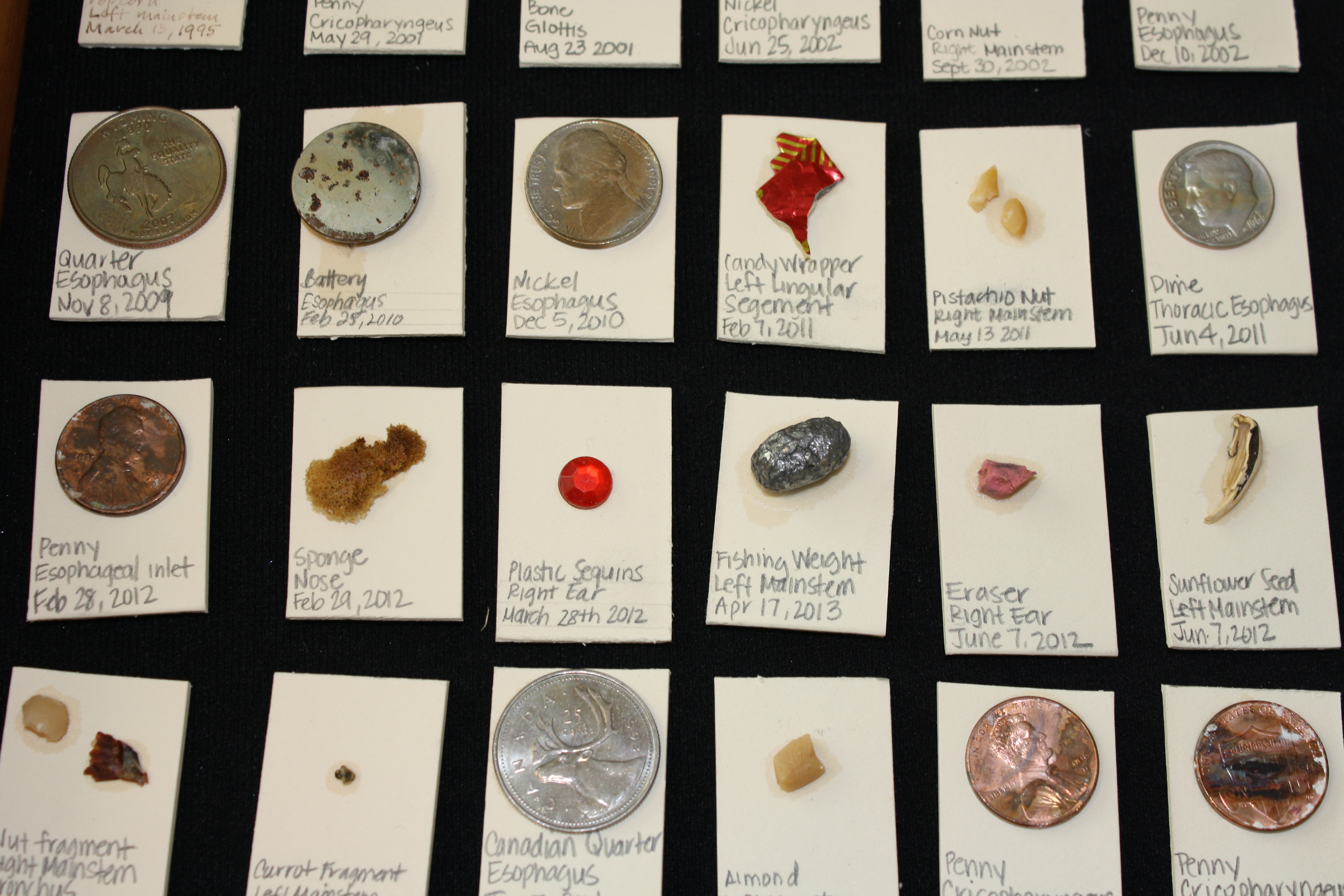 Dangers of children and small objects | king5.com