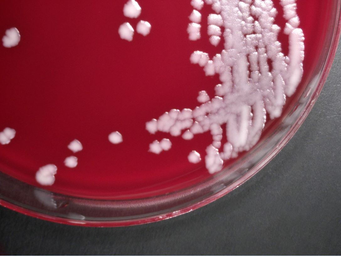 Private King County lab mistakenly sent live anthrax | king5.com