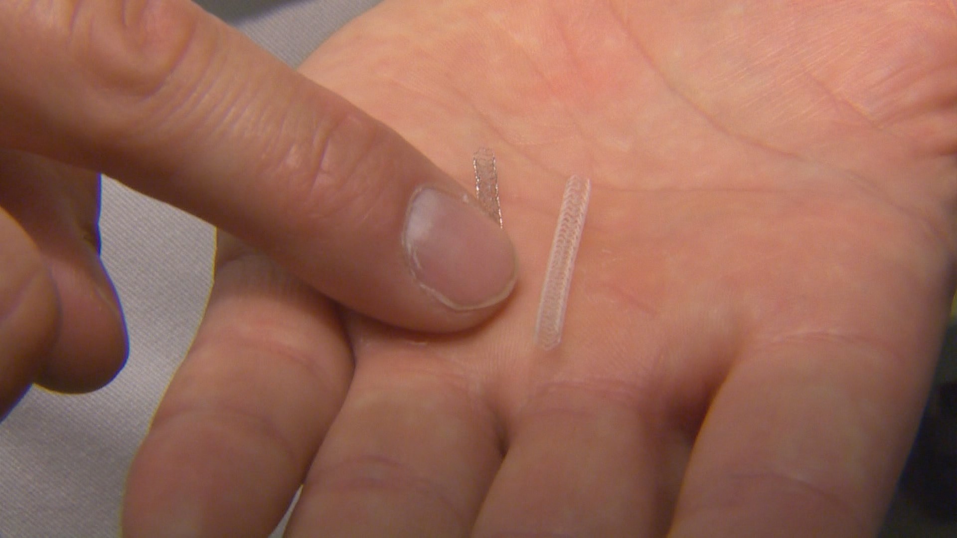 First use of dissolving stent in Washington state | king5.com