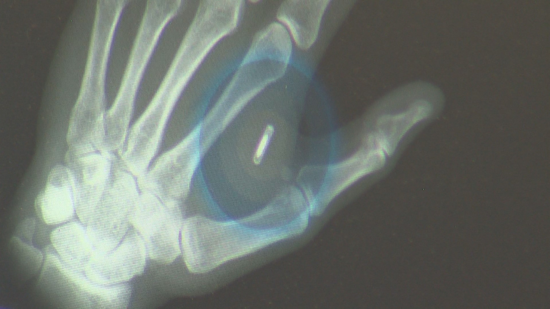 Skagit County company touts implant-activated gun | king5.com