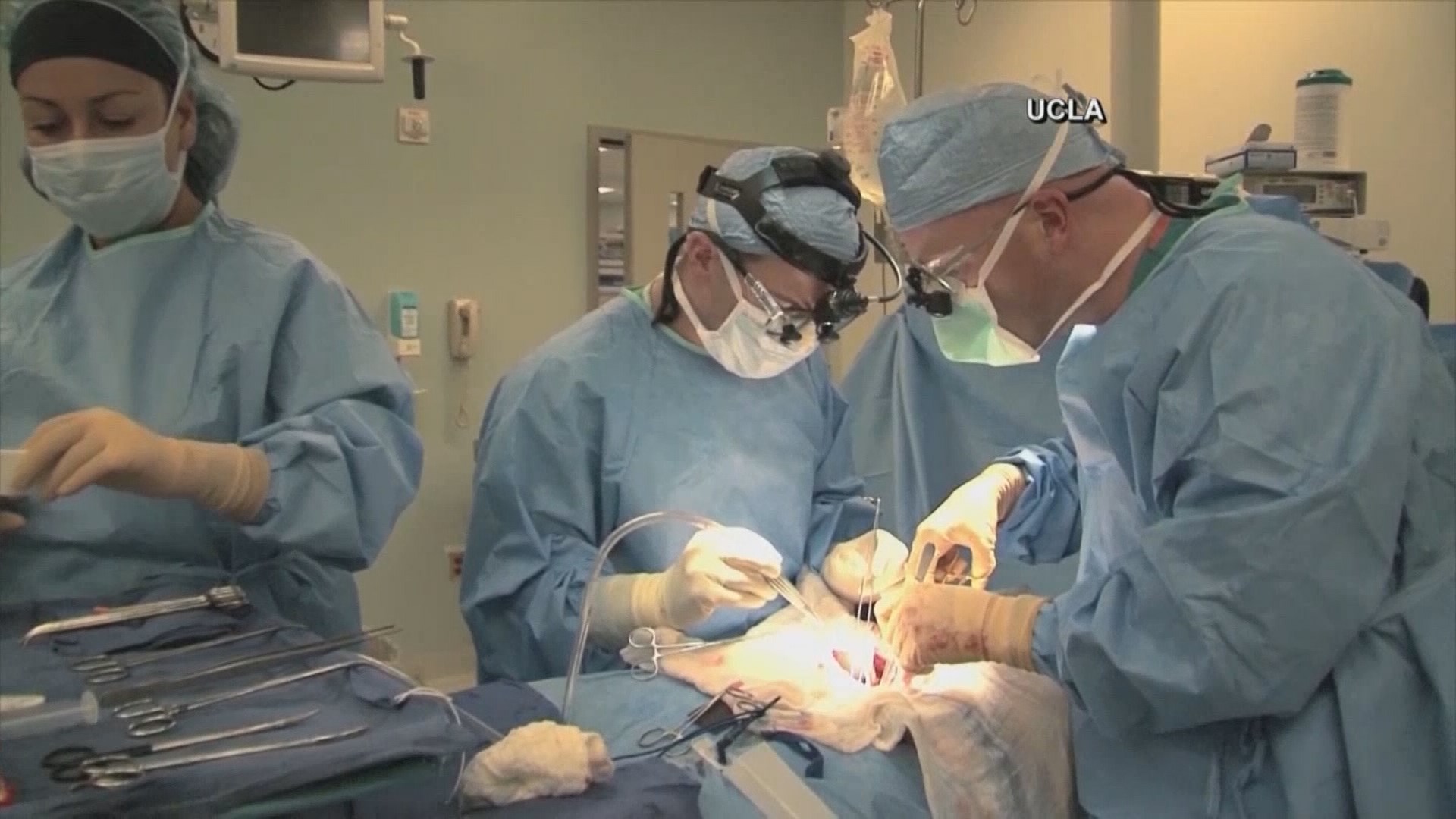 How To Donate Kidney For Money